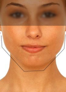 Wide Jaws - Kalpana Aesthetics